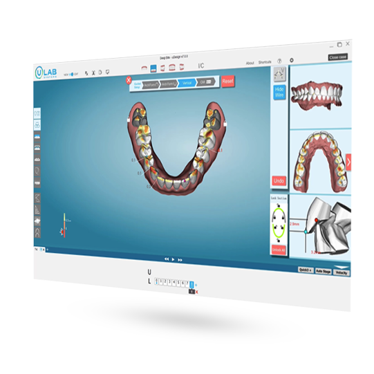 Press Releases - uLab Systems