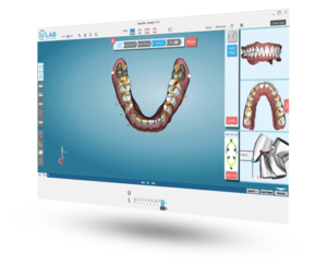 uDesign 9 - uLab Systems