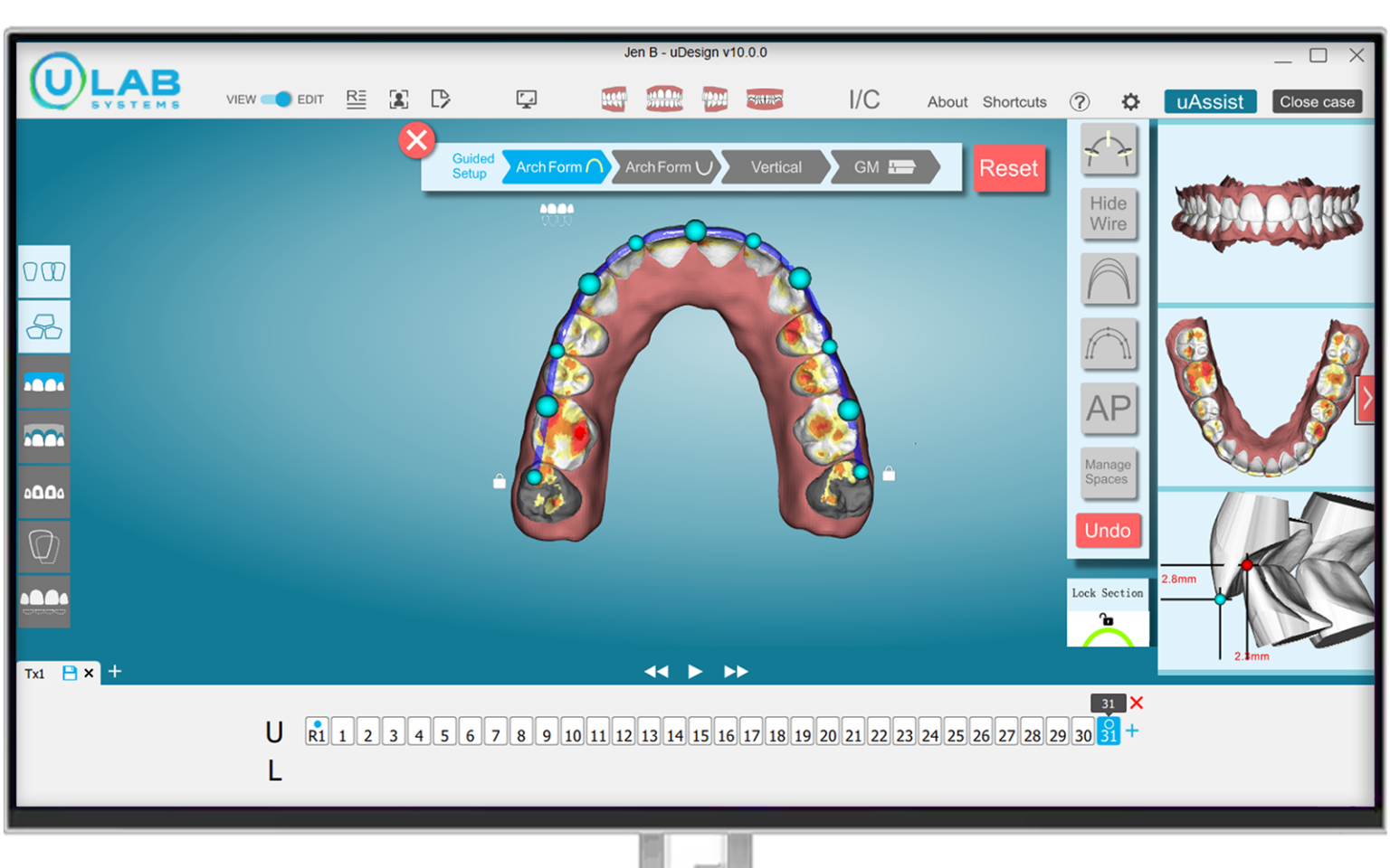 uDesign AI Software - uLab Systems